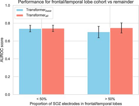 Figure 1 From Localising The Seizure Onset Zone From Single Pulse Electrical Stimulation