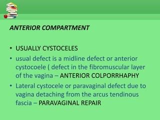 Uterine Prolapse Management Pptx