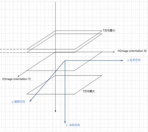 医疗影像容积重建 物体坐标系和渲染图像坐标系 Csdn博客