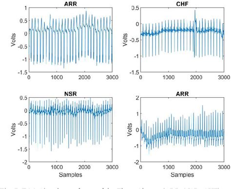 Figure 1 From Ecg Multi Class Classification Using Machine Learning Techniques Semantic Scholar