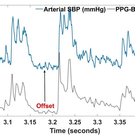 the block diagram of the ppg bpm algorithm 1 epoch pulse generator