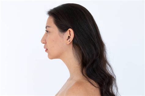 What Is A Reversed Cervical Curve Find Out Here The Bodyfix Mt