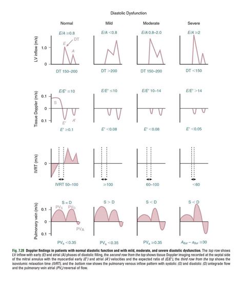 Diastolic Dysfunction Assessment Normal Mild Moderate Grepmed