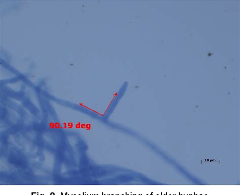 Figure 5 From Effect Of Inoculum Source Inoculum Pressure And Cultivar On Development Of Black