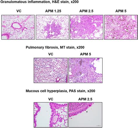 Representative Mt And Pas Stained Slides Of Lungs Obtained From Mice Download Scientific