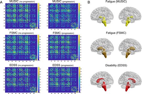 Matrices A And Network Hubs B From Structural Covariance Network Download Scientific
