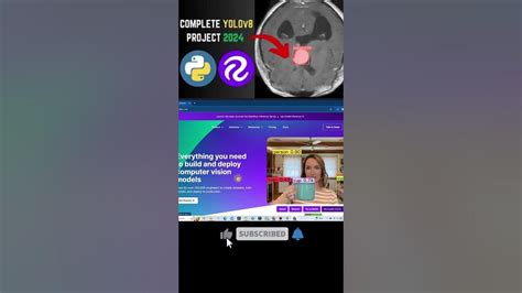 Brain Tumor Detection Using Yolov8 Project 2024 Freetech Shorts Youtube