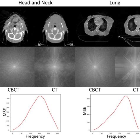 The Distribution Of Differences In The Frequency Domain Of Paired Cbct