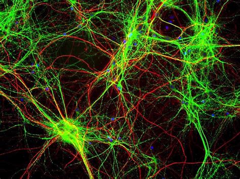 Scientists Have Made Fully Functional Artificial Human Brain Cells Business Insider