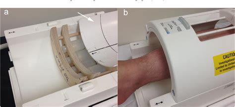 Figure 1 From Sex Differences In Sodium Deposition In Human Muscle And