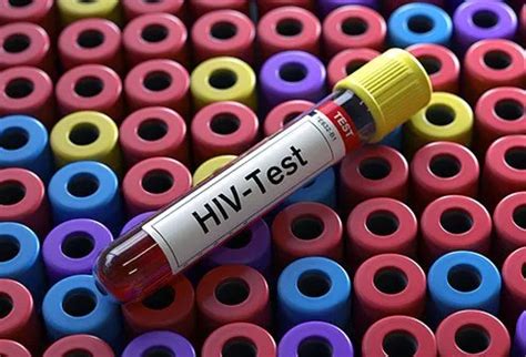 HIV Test Types Accuracy Of Results Of HIV Testing Kits
