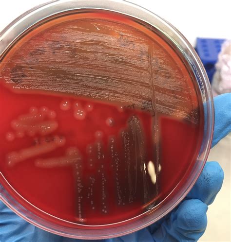 Streptococcus Pyogenes Free Download Borrow And Streaming Internet Archive