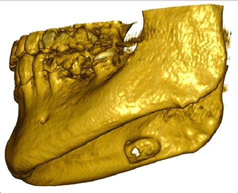 three dimensional cone beam computed tomography volume rendering