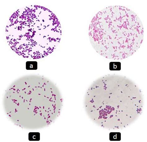 Streptococcus Faecalis Gram Stain