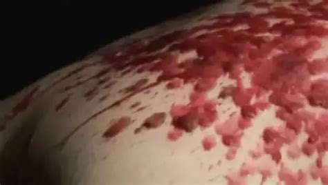 Japanese Candle Torture Fetish Xhamster