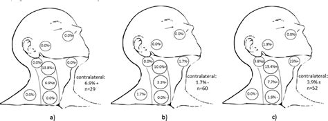 Figure 1 From Nodal Metastasis And Elective Nodal Level Treatment In Sinonasal Small Cell And