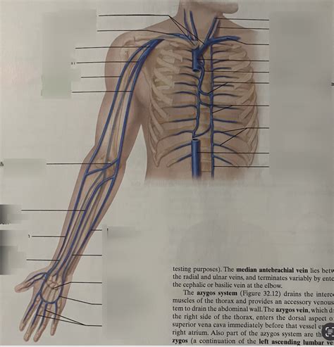 Ch 21quiz Diagram Quizlet