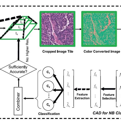 1 Shimada Classification Of Neuroblastic Tumor Download Scientific