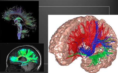 Neuroscience Techniques Flashcards Quizlet