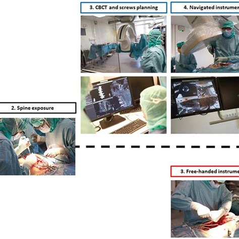 Surgical Workflow Comparison Between Augmented Reality Surgical