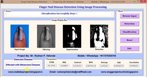 Finger Nail Disease Detection Using Machine Learning Full Project