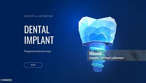 치과 용 임플란트 치과의 디지털 기술 다각형 미래 스타일의 틀니의 벡터 일러스트레이션 기하학적 발광 모양으로 표시된 어금니 수술 의치 접착제에 대한 스톡 벡터 아트 및 기타