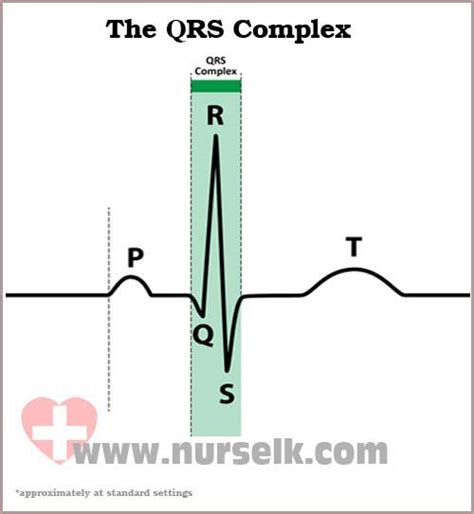 Wide Qrs Complex