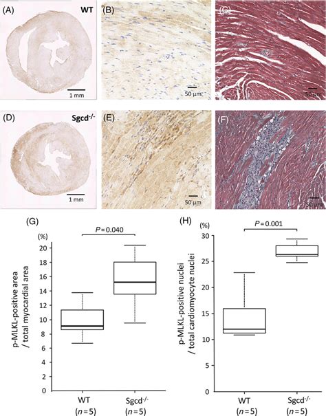 P‐mlkl Level In A Mouse Model Of Dilated Cardiomyopathy A B D E