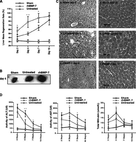 Rhbmp 7 Enhances Regeneration Of Liver Mass After Partial Hepatectomy Download Scientific