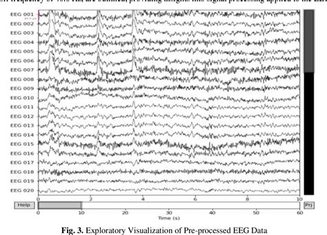 Figure 2 From Differentiating Mental Stress Levels Analysing Machine Learning Algorithms