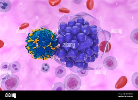 CAR T Cell Therapy In Diffuse Large B Cell Lymphoma DLBCL Closeup