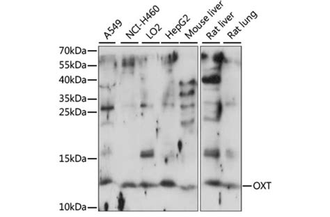 Anti Oxytocin Neurophysin 1 Antibody A88219