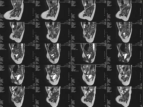 Practical Radiological Approach To A Case Of Intersex Ppt