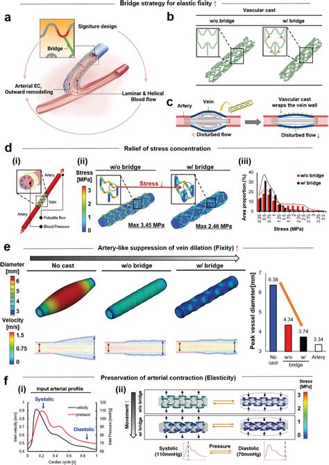 Computational Modelling Validation Of Bridge Advantages In Vascular Download Scientific Diagram