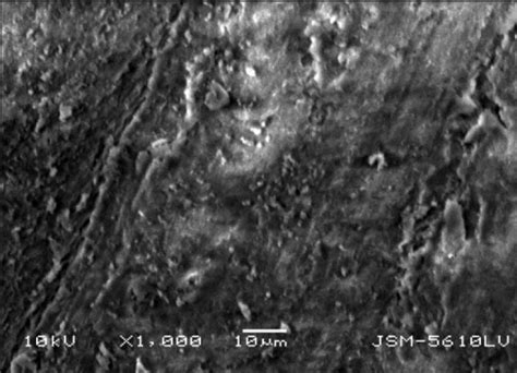 Group 1 SEM Micrograph Of Diseased Root Surface After Scaling And Download Scientific Diagram