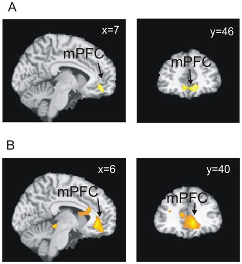 A Neural Responses To Increasing Social Exclusion In The Mpfc Of Download Scientific Diagram