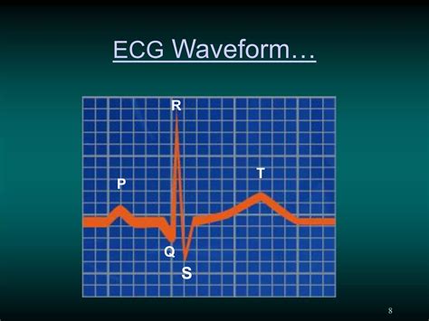 An Overview Of Paediatric Ecg Pdf