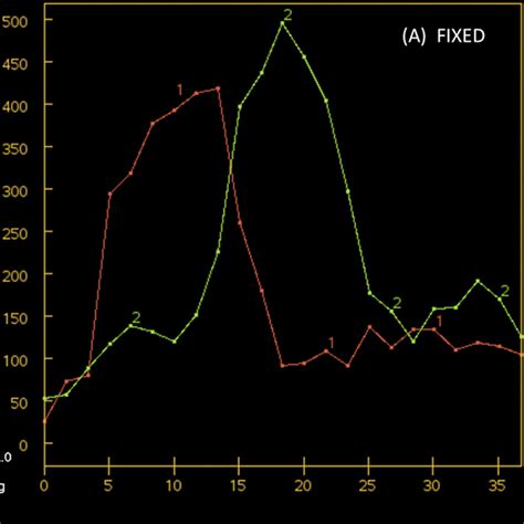 Innovations In CT Imaging Of Acute Stroke Adding Value Reducing Dose Improving Consistency