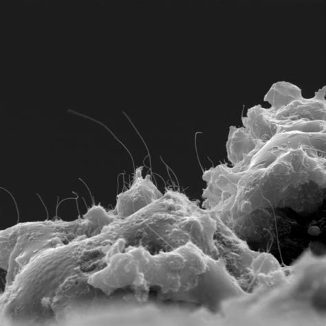 Want To Know How Micro X Uses Unique Carbon Nanotube Technology To