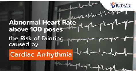 Irregular Heart Rhythm