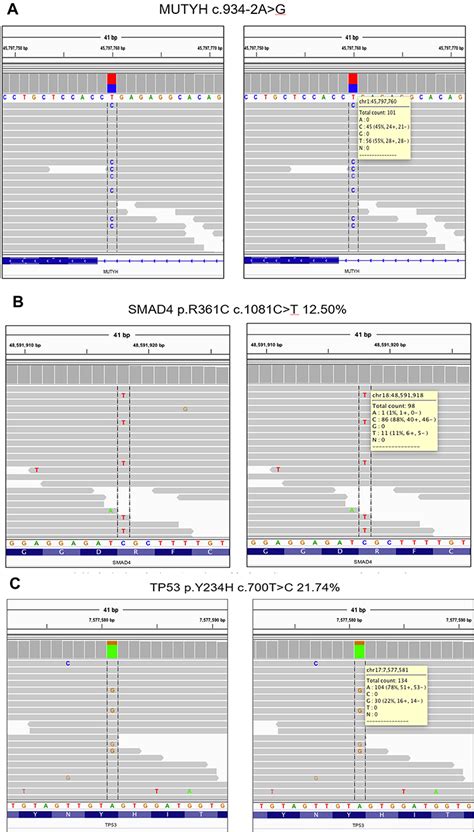 A Novel Mutation In Myh Gene Associated With Aggressive Colorectal Can