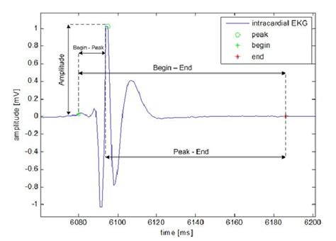Sample Calculations Within A Single Impulse Detected Download Scientific Diagram