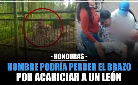 Tocar El Brazo A Un Hombre