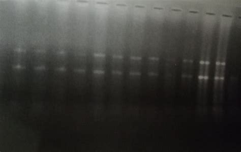 Why My Total Rna Samples Do Not Have Clear Two Bands Researchgate