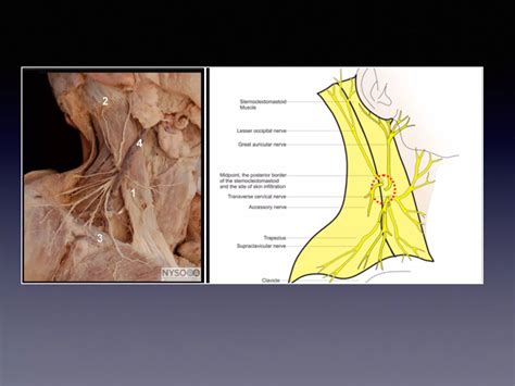 Shoulder Block Tutorial 2014 Ppt Free Download Shoulder Block Tutorial 2014 Ppt Free Download
