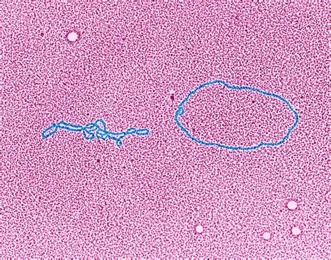 Lambda Phage Dna Tem Stock Image C0320369 Science Photo Library