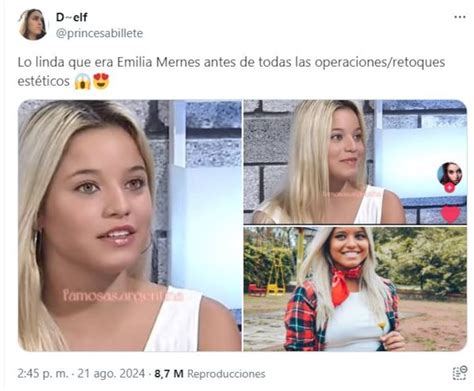 Emilia Mernes Mostró Su Impactante Cambio Físico Y Sorprendió A Sus Seguidores Tn