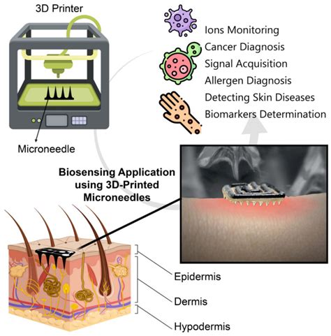 3d Printed Microneedles For Point Of Care Biosensing Applications Pmc