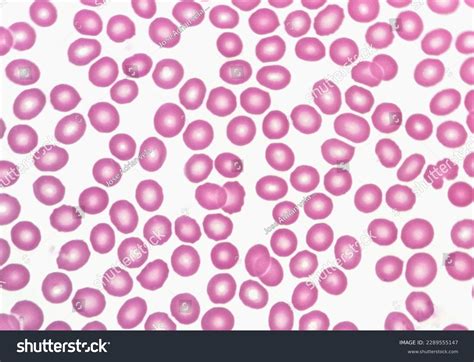 Globulos Over 3 Royalty Free Licensable Stock Illustrations And Drawings Globulos Over 3 Royalty Free Licensable Stock Illustrations And Drawings