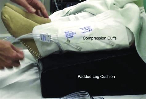 Intraoperative Photograph Demonstrating The Use Of Sequential Download Scientific Diagram